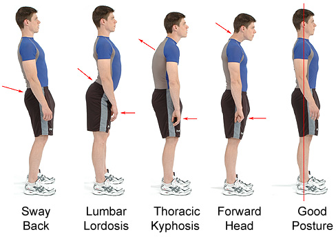 Gathering The Ideas: PROPER STANDING POSTURE