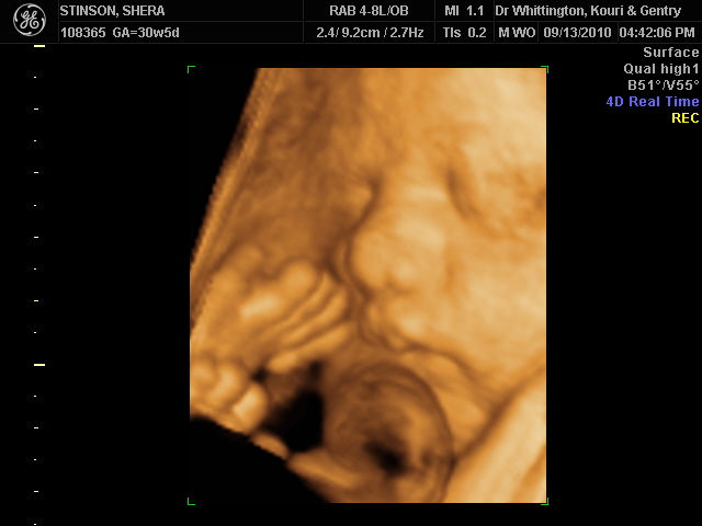 Stinson Scoop: 4D Ultrasound at 30 Weeks/7 Months
