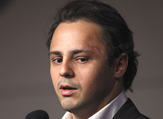 Felipe Massa: Pictures: Felipe Massa shows off his scar