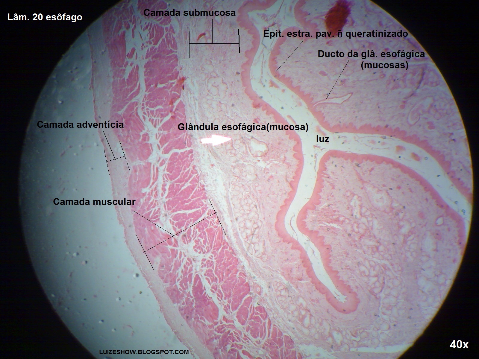Luiz é show: Histologia