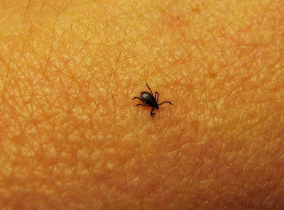 In the Field: Feels like there's a bug crawling across my skin...