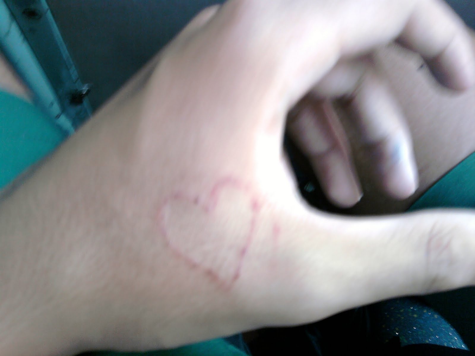 Cut a heart shape on my hand wif my ((NEw Brought pen knife in our sch ...