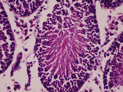 My experiments with Mice: Histology of mice testis