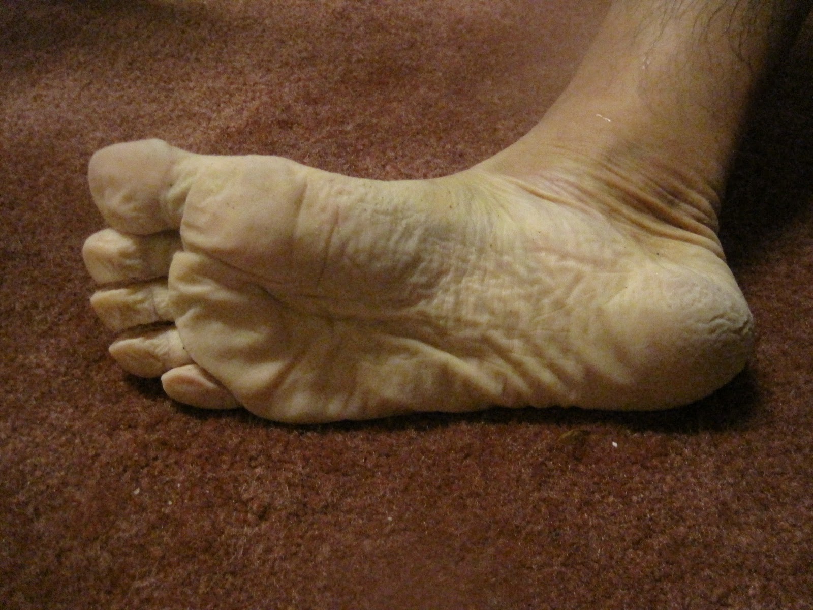 Ultrarunning ER Doc: Pure Endurance -- My 2nd SF One Day 24-Hour Race