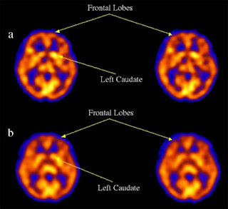 America's Liberal Progressive Idea: The God Spot, Biology, Evolution ...