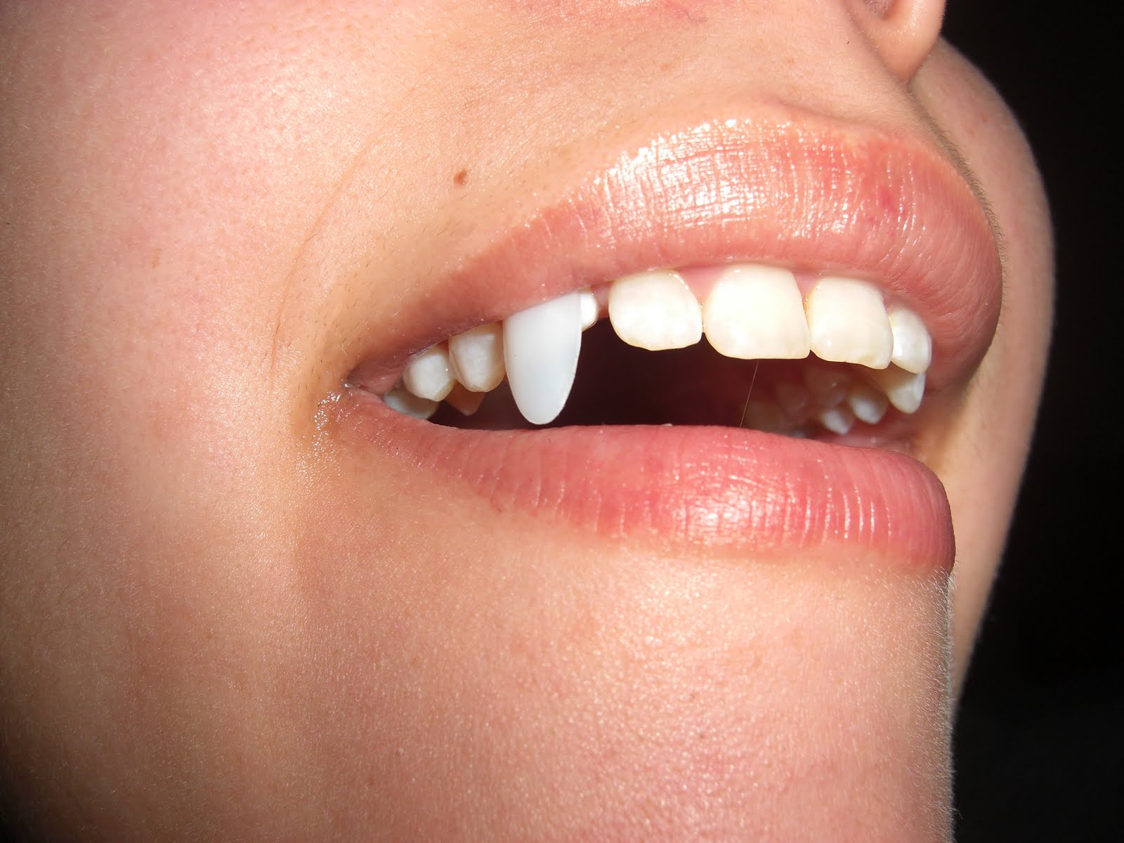 Ryuuzaki-chan no blog: Tutorial: colmillos falsos