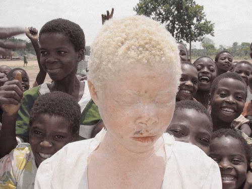 Las Fotos Mas Alucinantes: negro albino