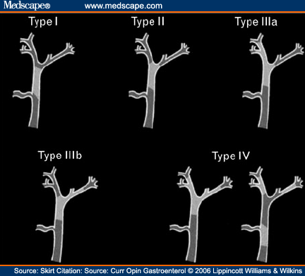 Medical Center: Cholangiocarcinoma