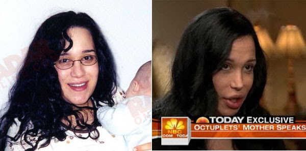 Nadya Suleman Before And After Plastic Surgery