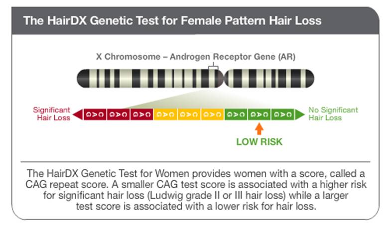 Good Bye Hair Loss - Hair Loss Tips & Advice Online: Hair Genetics and ...