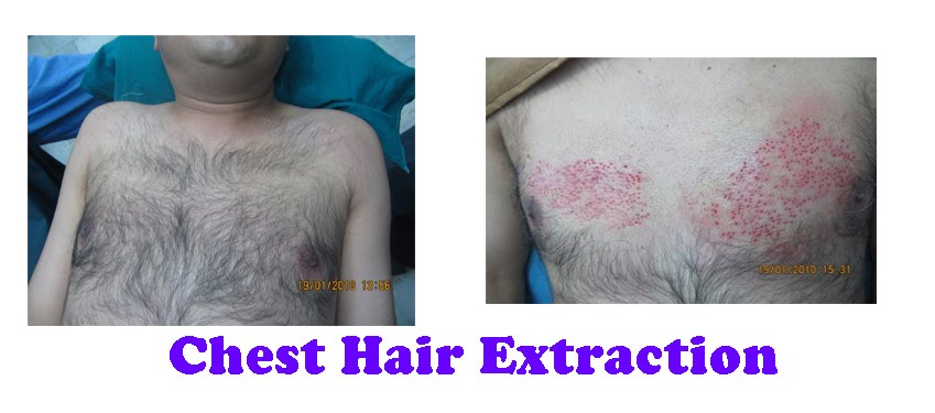 Good Bye Hair Loss - Hair Loss Tips & Advice Online: Body Hair ...