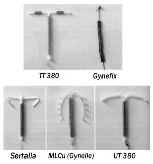 Futura partera: El DIU