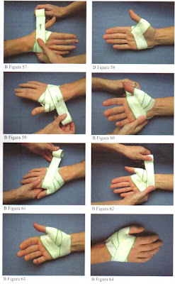 EMFV - Escuela de Porteros: TIPOS DE VENDAJES PARA LOS PORTEROS