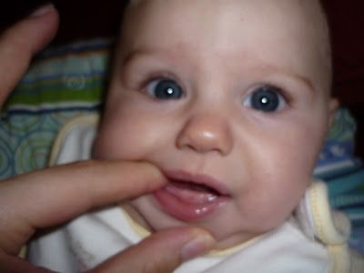 The Merkel Family: The first tooth bud