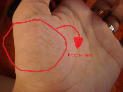 Simple Yet Rock: My Left Hand Injury