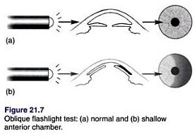 What is the oblique flashlight test? | little white coats