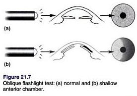 What is the oblique flashlight test? | little white coats