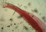 PARASITARIAS: BUNOSTOMUM