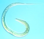 PARASITARIAS: BUNOSTOMUM