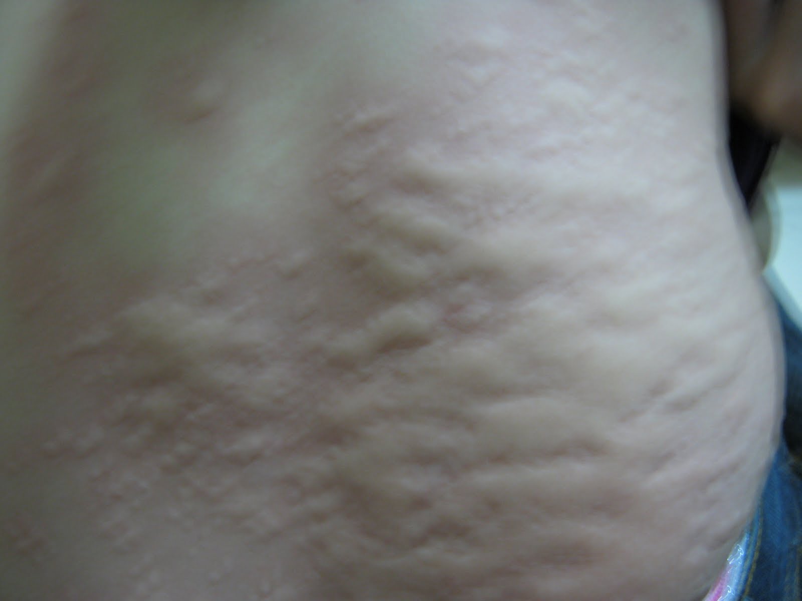 Saging lang ang may puso: Pantal na pasaway