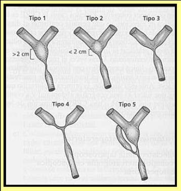 SERVICIO DE CIRUGIA GENERAL: VIA BILIAR Y VESICULA