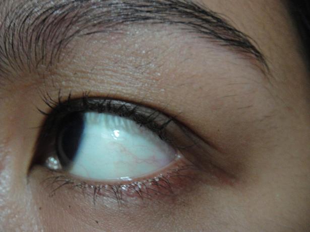 Whiter Eyes With Rohto Eye Drops! ~ I Am Your Every Woman