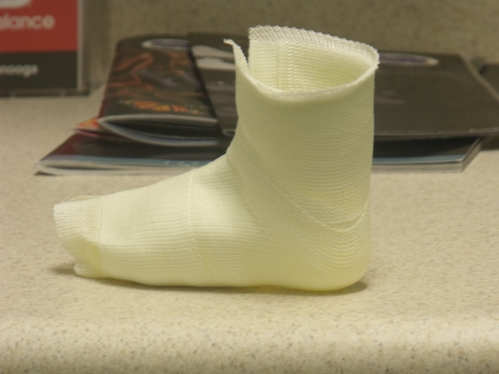 I Support Early Intervention: DD's Story Orthotics