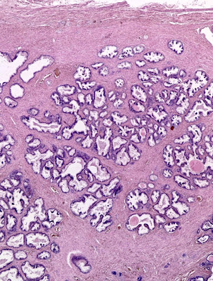 Tecnología Médica Mención Morfofisiopatología y Citodiagnóstico ...