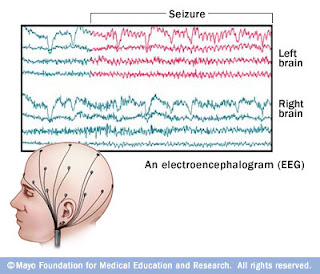 Healthy Life: EEG (electroencephalogram)