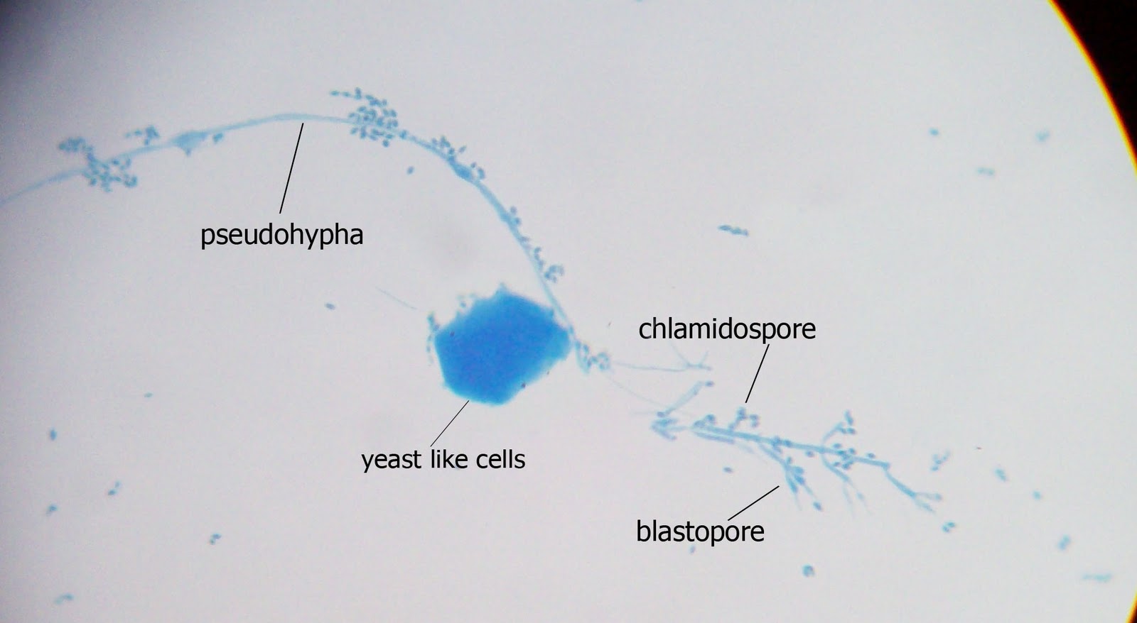 Biology "Back To Nature": jamur ragi