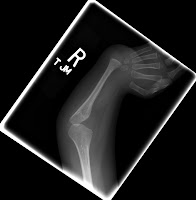 Rob's Radiology: June 2009