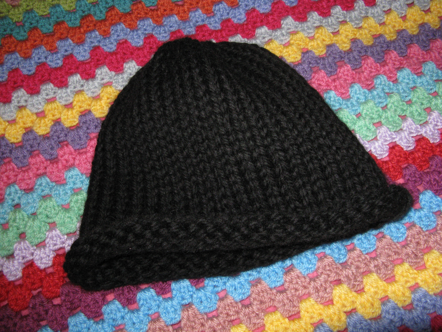 Hypertrophic marginal spurring of s1 / post patellar spurring, [mild ...