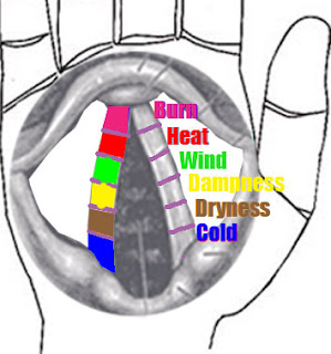 Acupuncture for singers and musicians: Vocal cords mapping and treatment