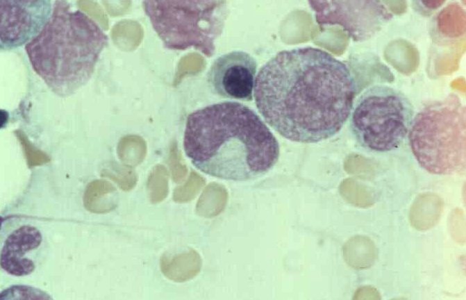 EL RINCÓN DE LA MEDICINA INTERNA. juanpedromacaluso@yahoo.com.ar: 26 ...