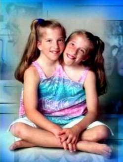 Siamese Tweeling Abby En Brittany