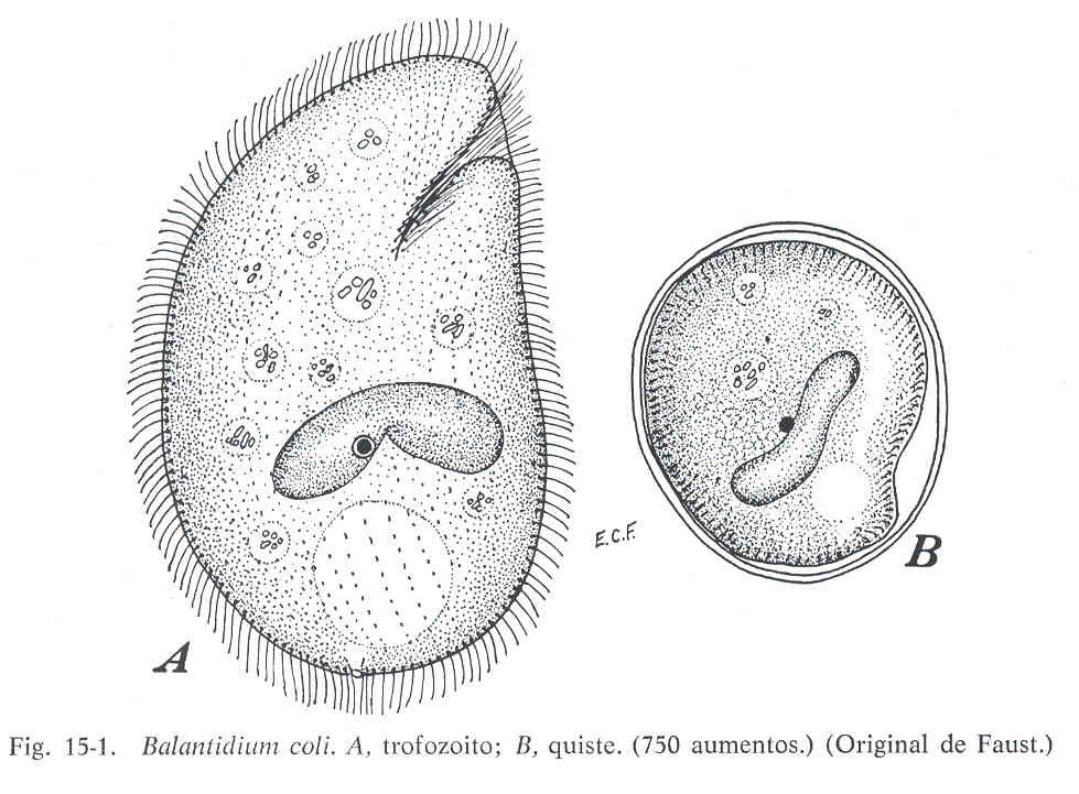 Parasitología: Protozooarios parásitos: Balantidium coli -Toxoplasma