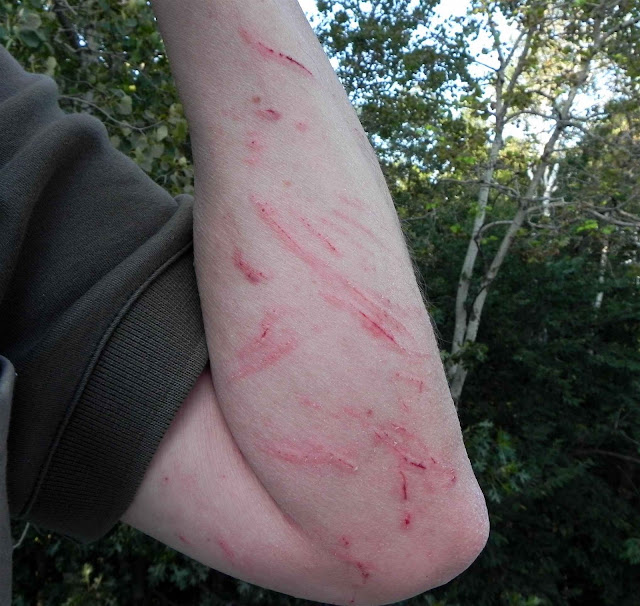 TYWKIWDBI ("Tai-Wiki-Widbee"): Brambles Ripped my Flesh