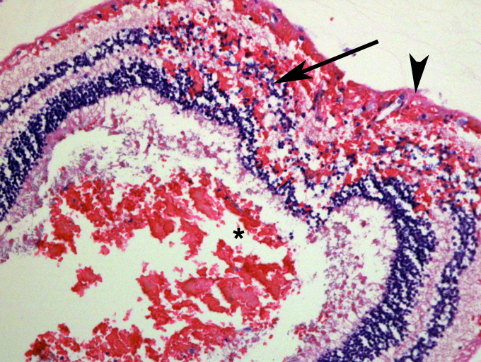 Forensic Pathology Blog: December 2010