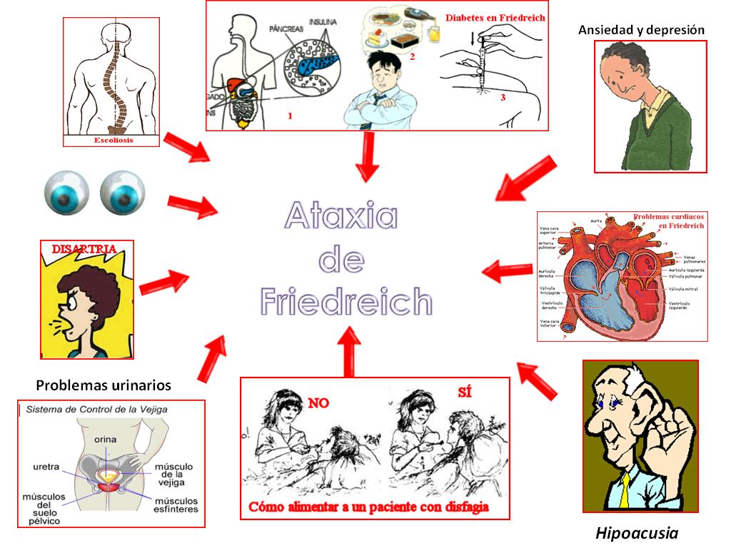 Marcha Atáxica; Marcha Insegura; Marcha Cambaleante; Marcha Ebriosa ...