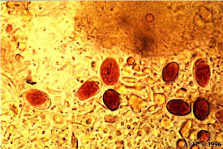 Protozoarios: Balantidium coli y Giardia lamblia: Giardia lamblia