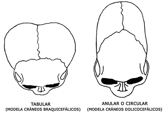 Los diversos humanos: Clasificación según el cráneo