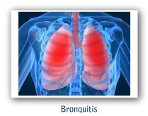CONOCERNOS ¿qué nos quiere decir el cuerpo con la enfermedad?: BRONQUITIS