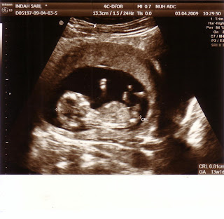 The Joyful Nine Months: 12 weeks 5 days during OSCAR Test