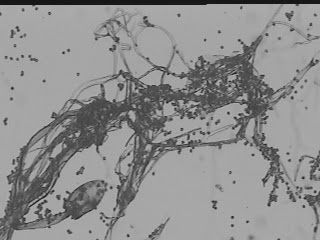 THE FLY: HIFA JAMUR (jamur mikroskopis)