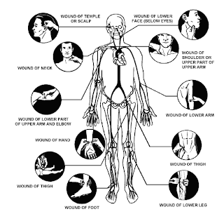 100 things about the martial arts: Pressure points