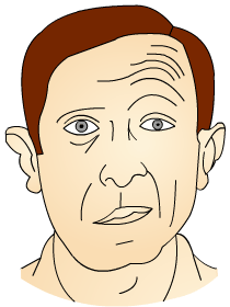 Medical Topics and Tips: Bell's Palsy