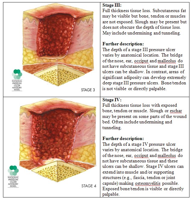 Npuap Pressure Ulcer Staging Guide