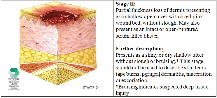 Npuap Pressure Ulcer Staging Guide