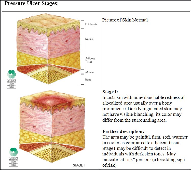 Npuap Pressure Ulcer Staging Guide