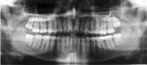 Allen Family Dentistry, LLC: Why does Allen Family Dentistry take ...